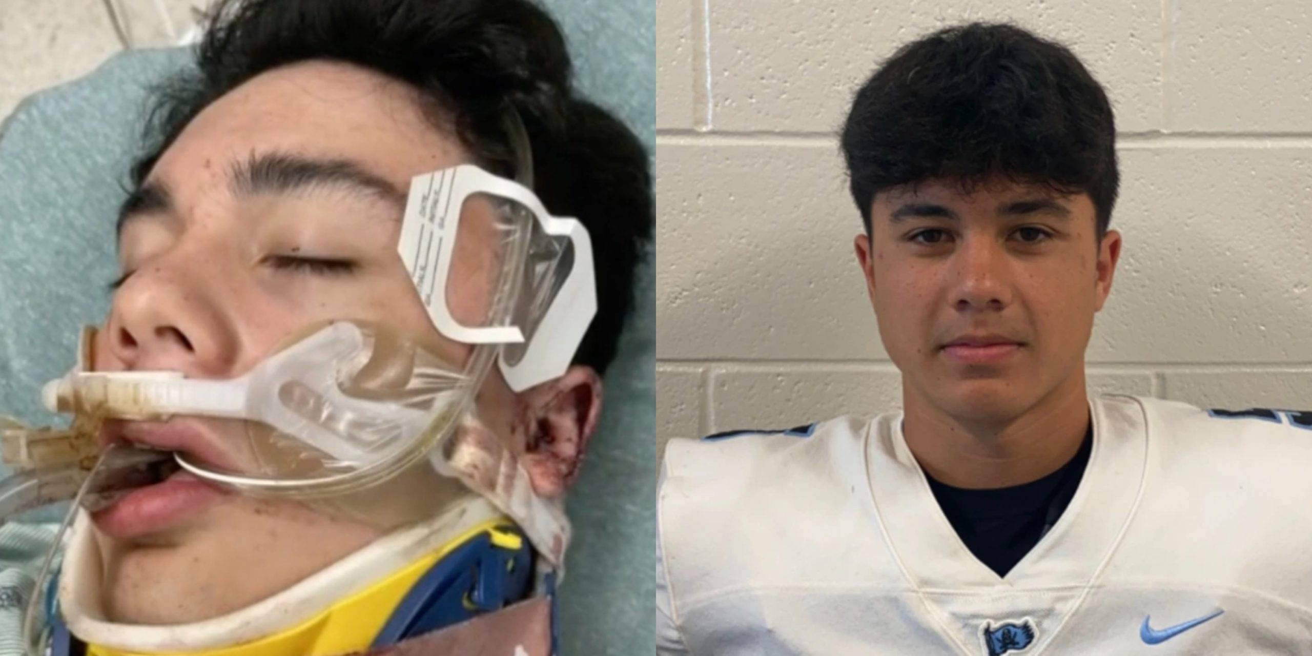 3 Teens Now Charged With Aggravated Assault After Brutally Beating 16 ...