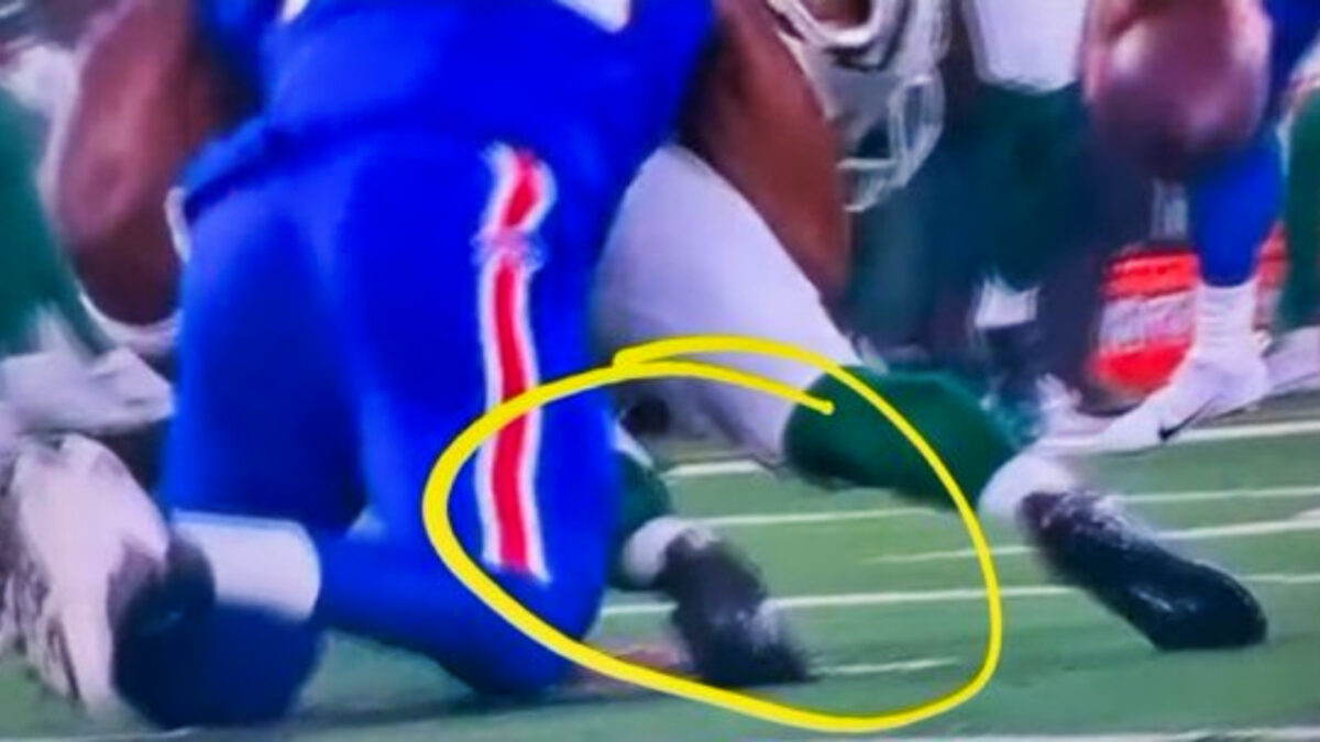 Gruesome Slo-Mo Video Shows Close-Up Of Aaron Rodgers’ Injury