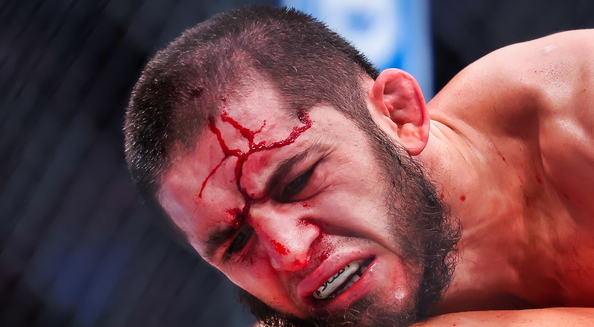 Islam Makhachev’s Injury Update Sparks Renewed Hope And Title Defense Buzz