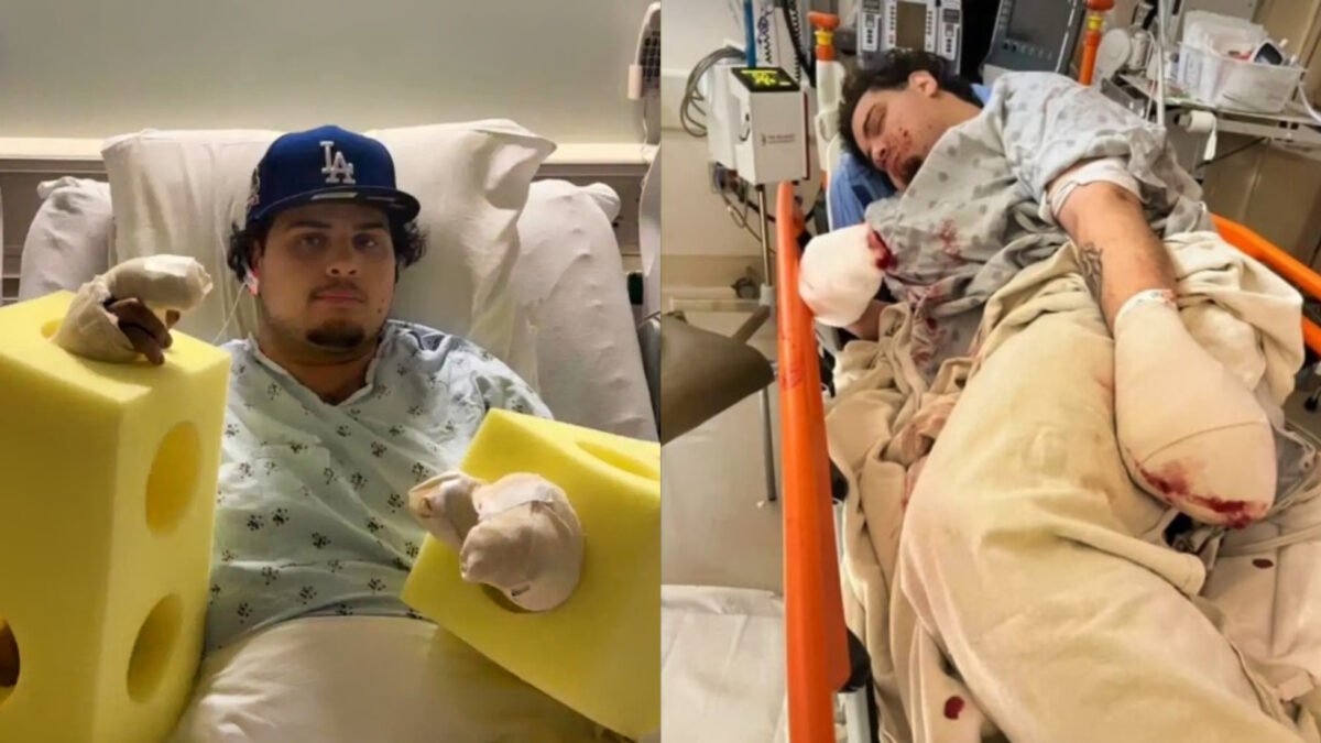 VIDEO: Dodgers Fan Who Blew His Own Hand Off While Celebrating Team’s ...