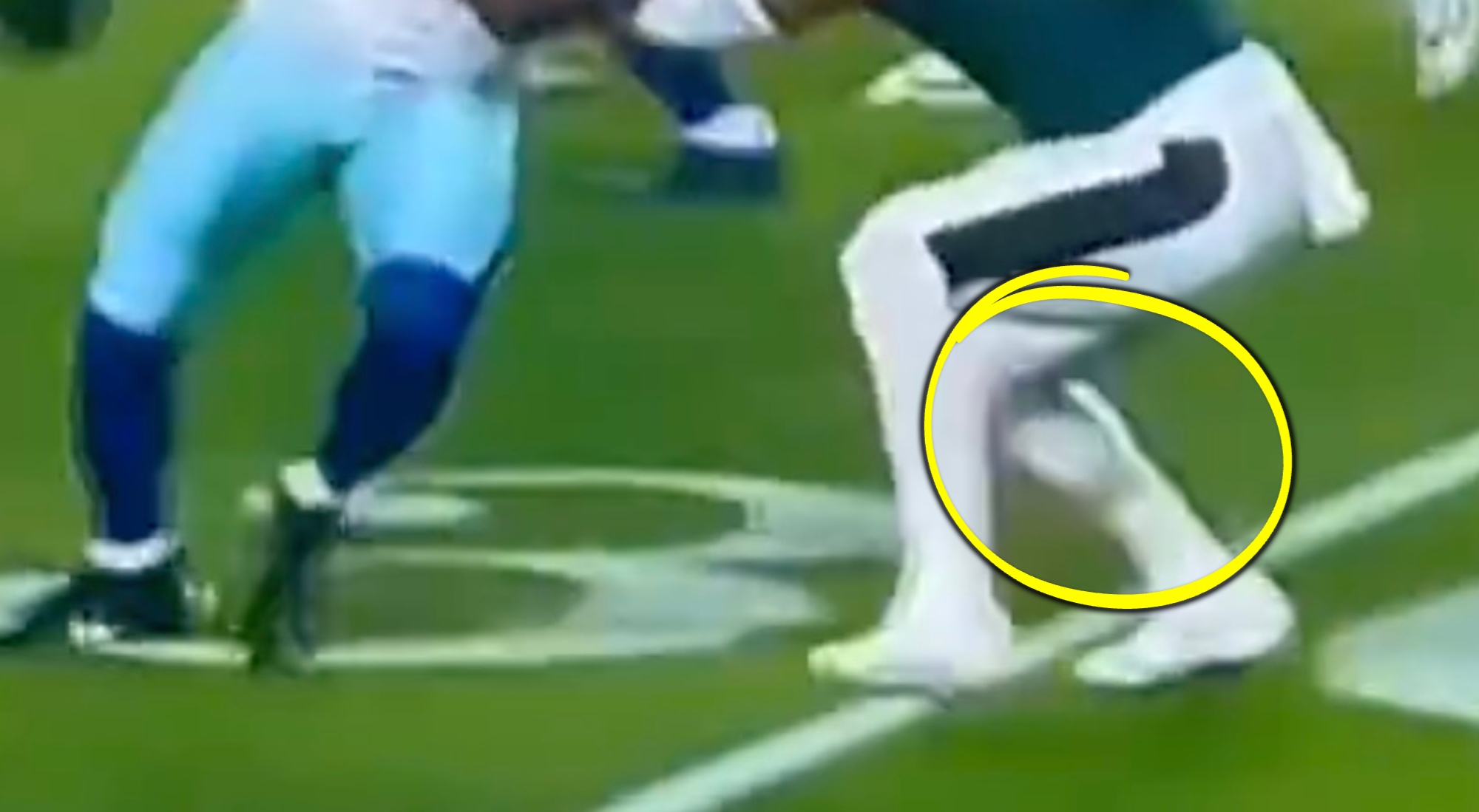 Zoomed-In Slow-Motion Video Shows Eagles Player’s Leg Blowing Up In ...