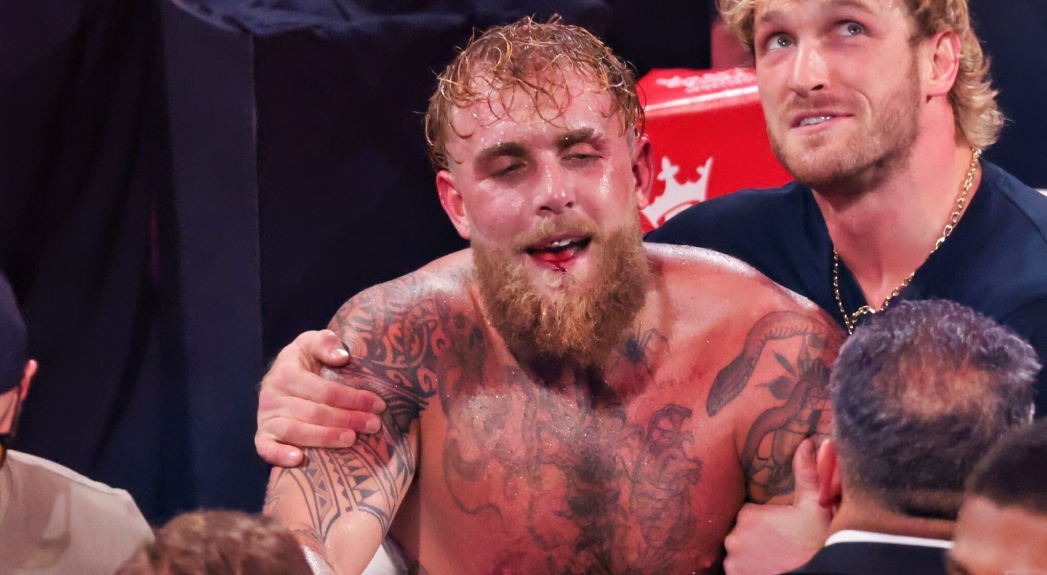 Shocking Images Of Jake Paul's Swollen Face Leak Online After Anthony ...