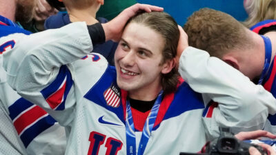 How Did Jack Hughes Lose His Teeth? The Truth Behind His Olympic Smile