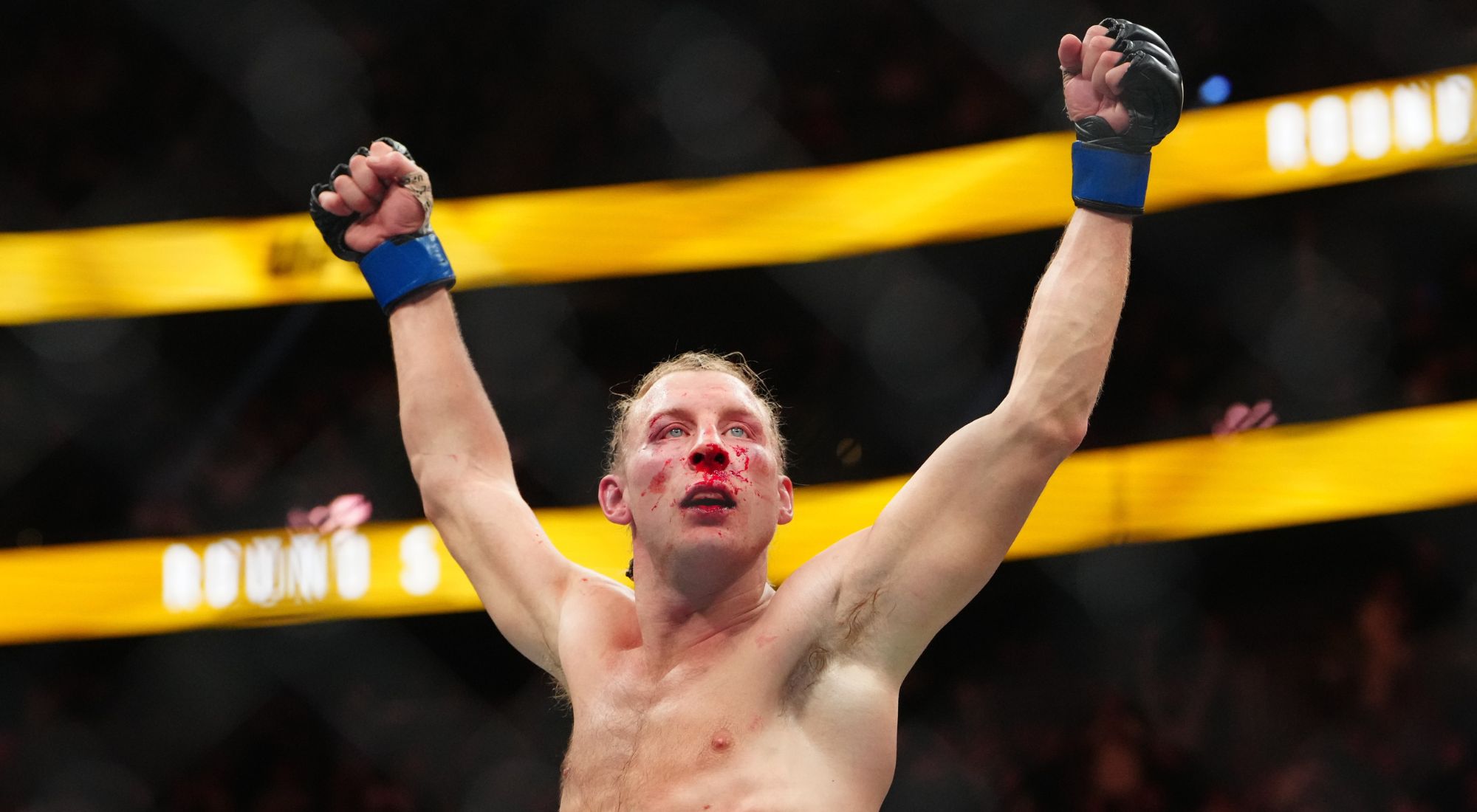 Paddy Pimblett Ready to Move On From Justin Gaethje Loss, Eyes Summer ...